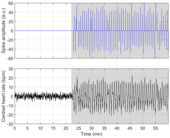 Sparse Decomposition of Heart Rate Using a Bernoulli-Gaussian Model: Application to Sleep Apnoea ...