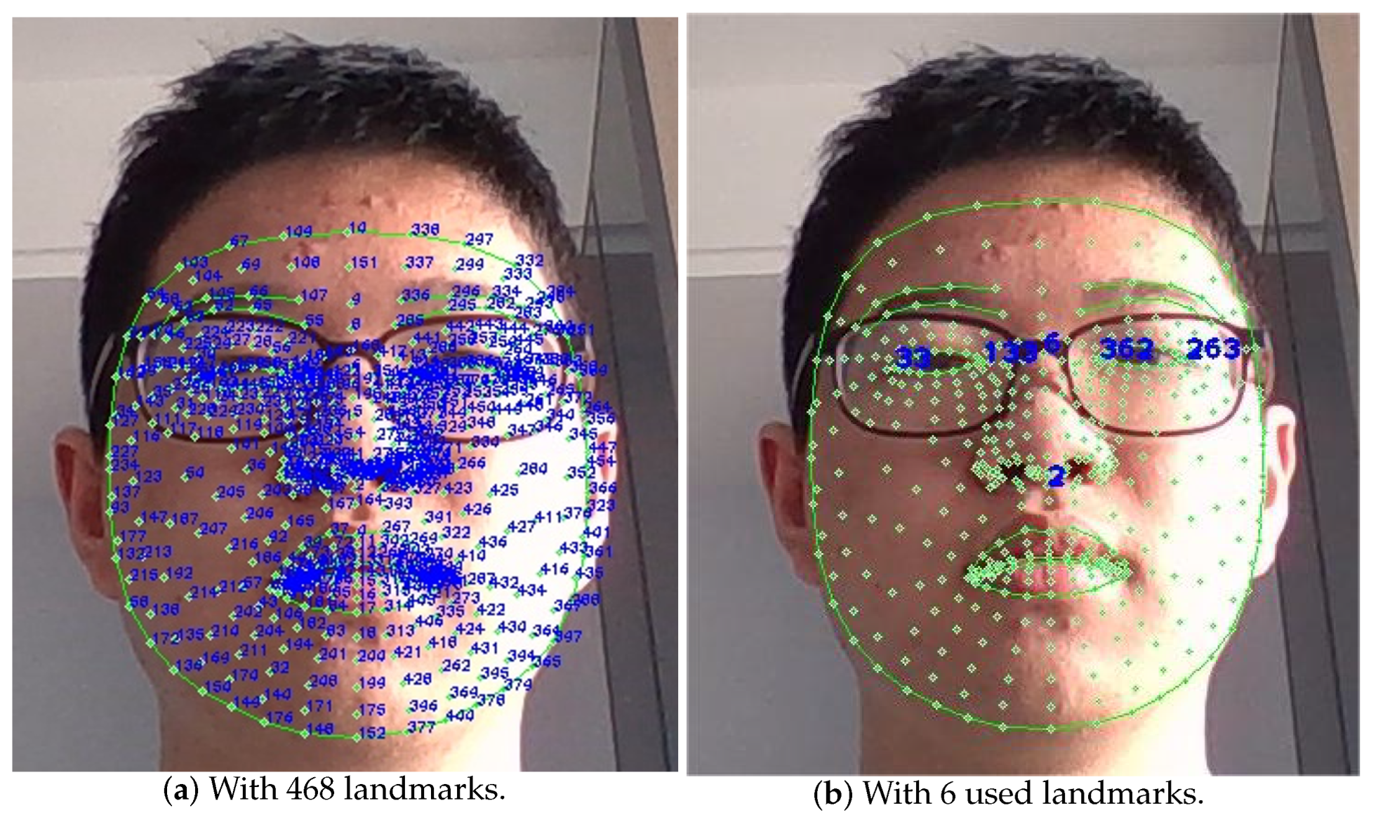 Intelligent Evaluation Method of Human Cervical Vertebra Rehabilitation ...
