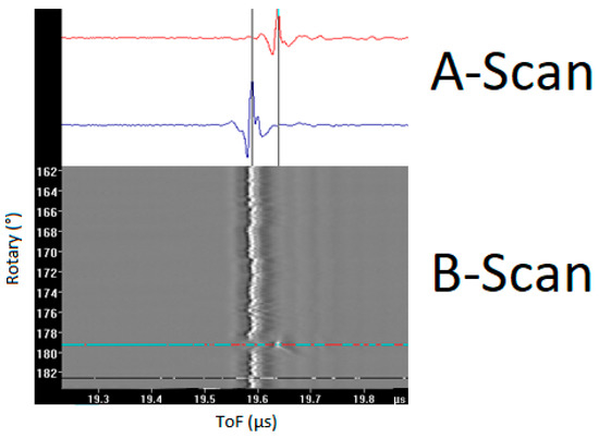 Auto Sizing of CANDU Nuclear Reactor Fuel Channel Flaws from UT Scans