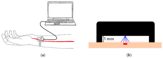 Continuous Non-Invasive Blood Pressure Measurement Using 60 GHz-Radar—A ...