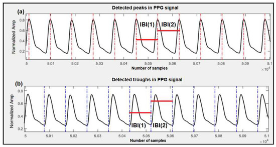A PPG-Based Calibration-Free Cuffless Blood Pressure Estimation Method ...