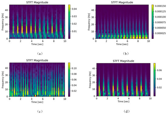 Automatic Classification Method of Arrhythmias Based on 12-Lead Electrocardiogram