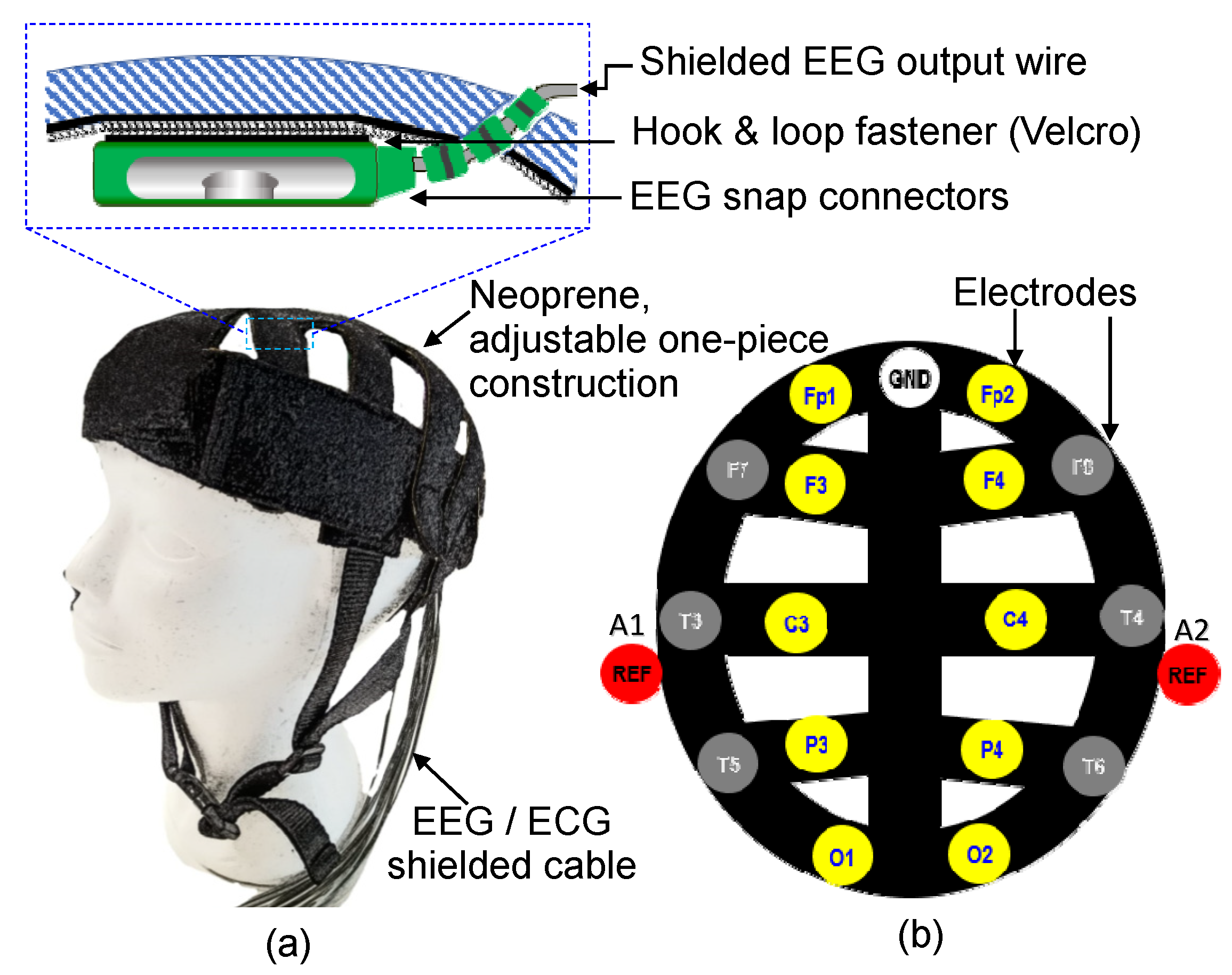 Development of Low-Contact-Impedance Dry Electrodes for Electroencephalogram Signal Acquisition