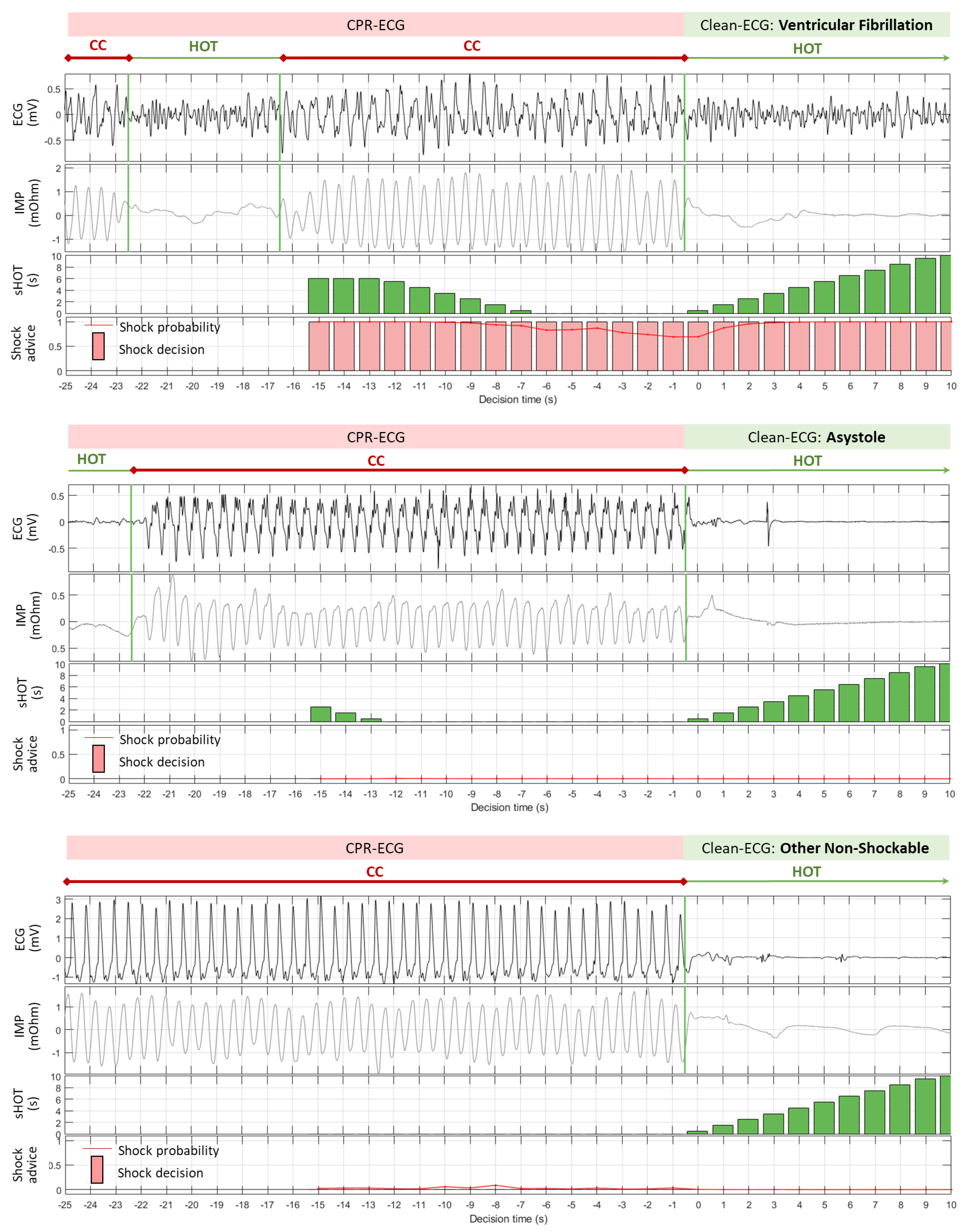 Deep Learning Strategy for Sliding ECG Analysis during Cardiopulmonary ...