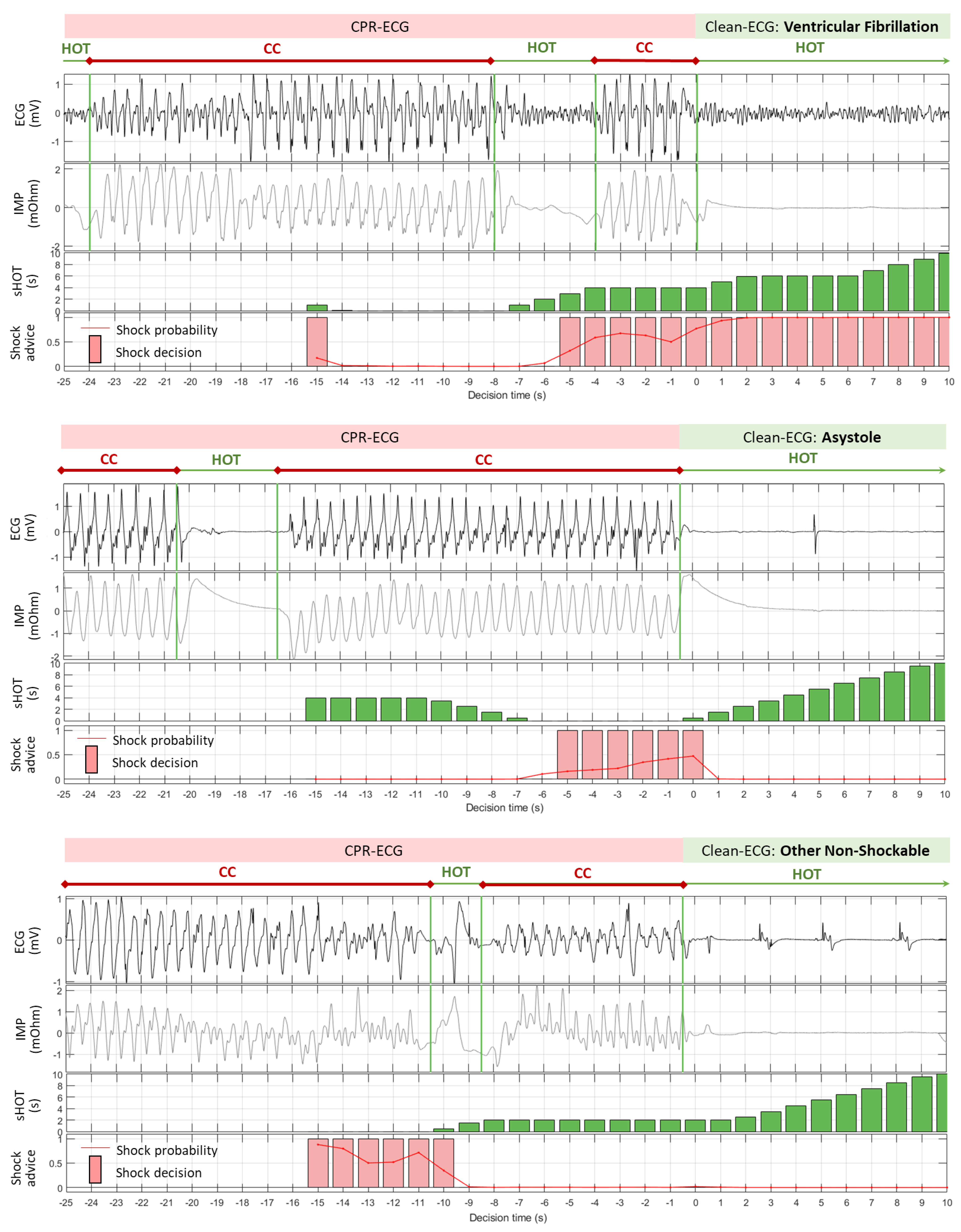 Deep Learning Strategy for Sliding ECG Analysis during Cardiopulmonary ...