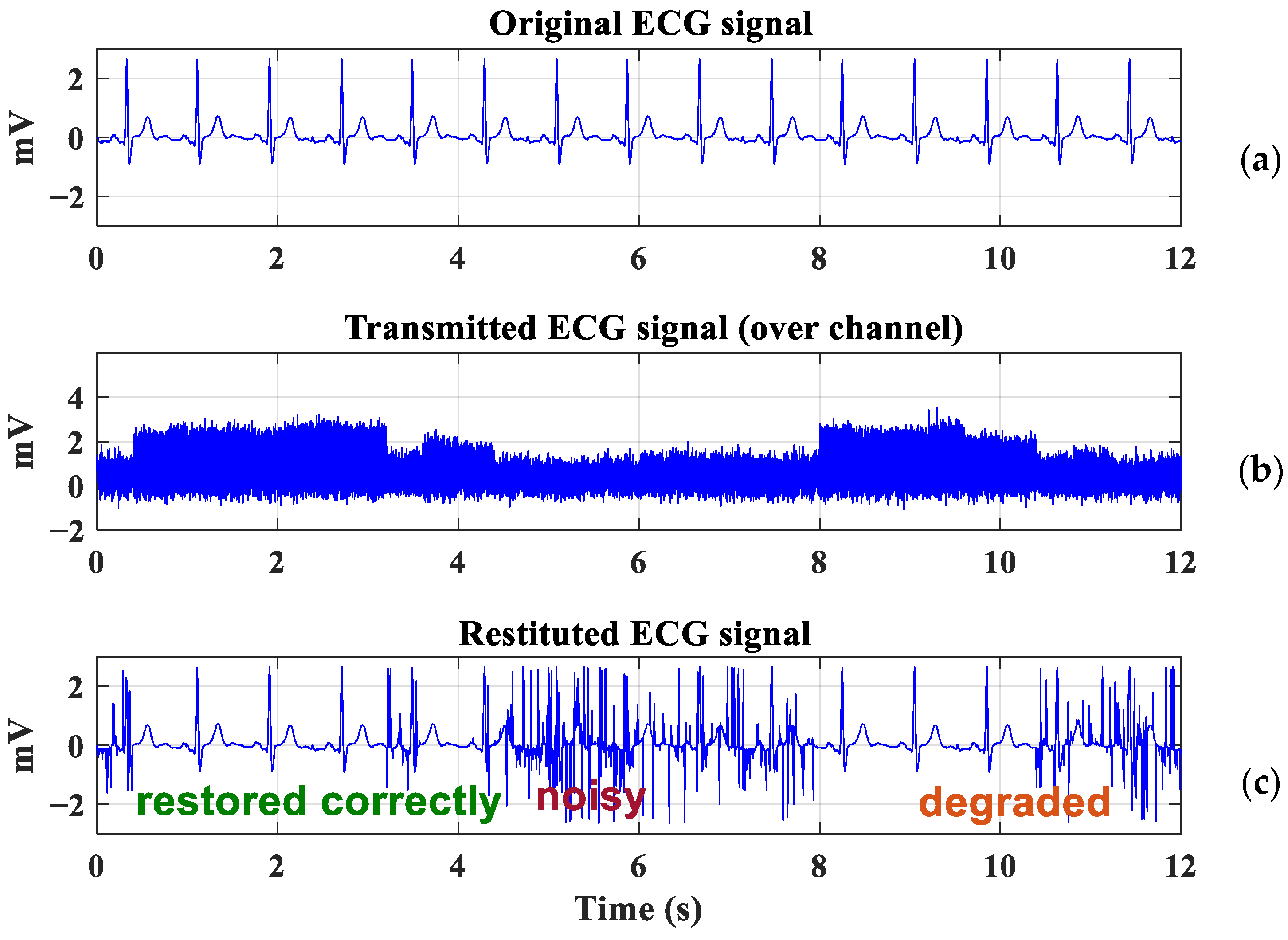 Quality Indexes of the ECG Signal Transmitted Using Optical Wireless Link