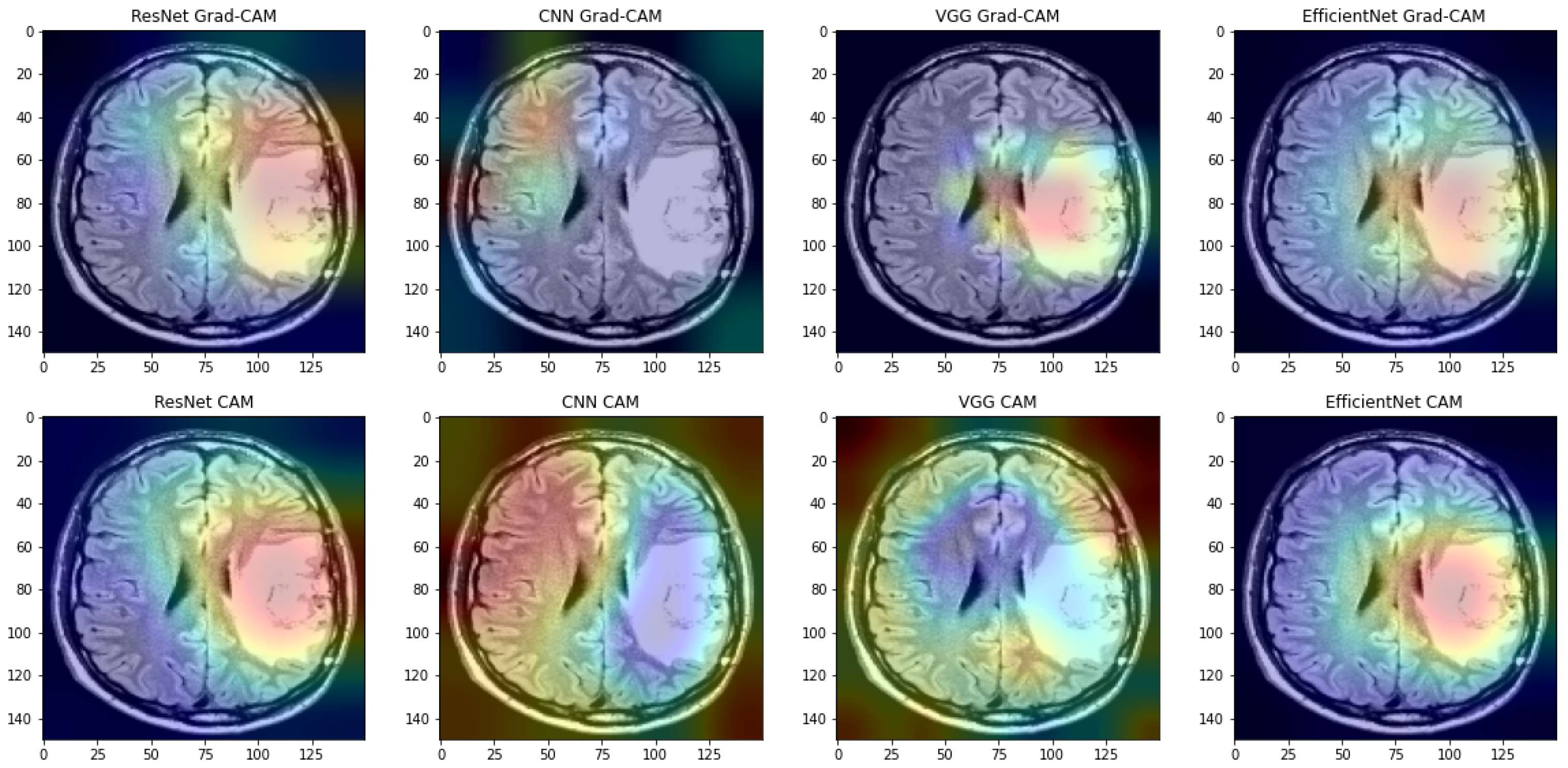 GitHub - johnnys7n/Multiclass-Brain-Detection-Tool: Predicting age of ... GitHub - johnnys7n/Multiclass-Brain-Detection-Tool: Predicting age of ...