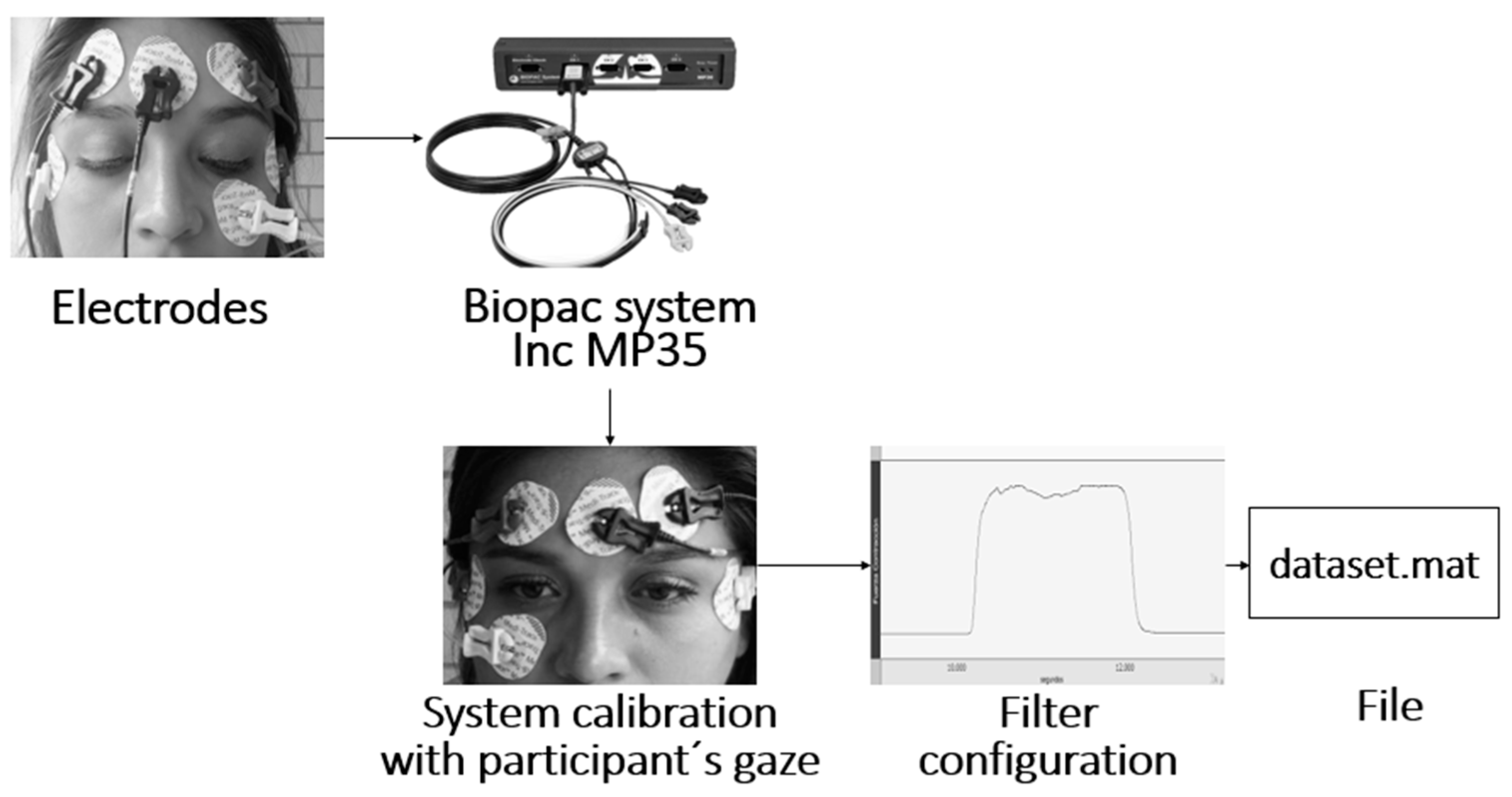 Sensors | Free Full-Text | EOG Signal Classification with Wavelet and Supervised Learning ...