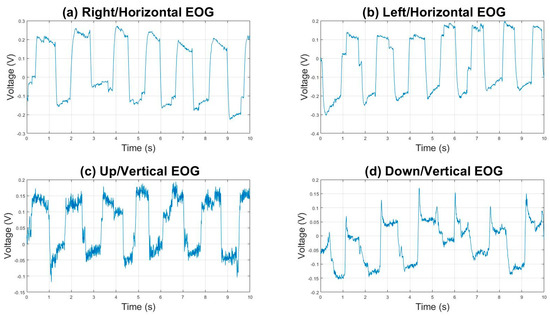 Sensors | Free Full-Text | EOG Signal Classification with Wavelet and Supervised Learning ...