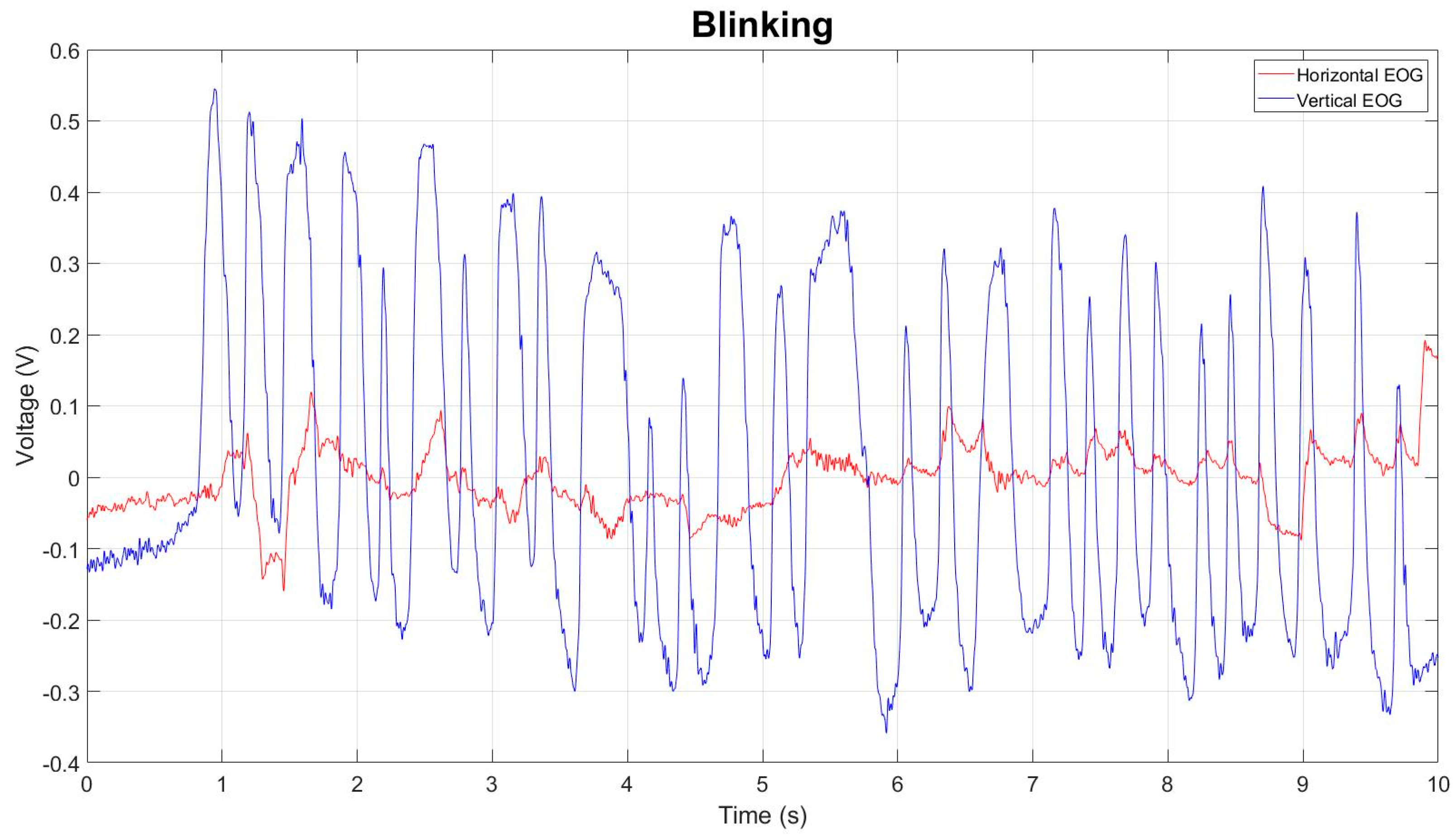 Sensors | Free Full-Text | EOG Signal Classification with Wavelet and Supervised Learning ...