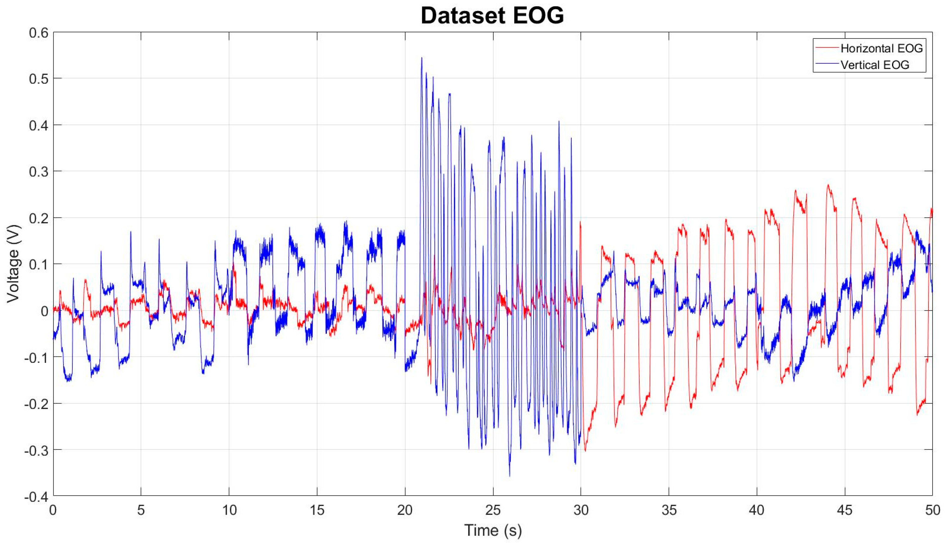 Sensors | Free Full-Text | EOG Signal Classification with Wavelet and Supervised Learning ...