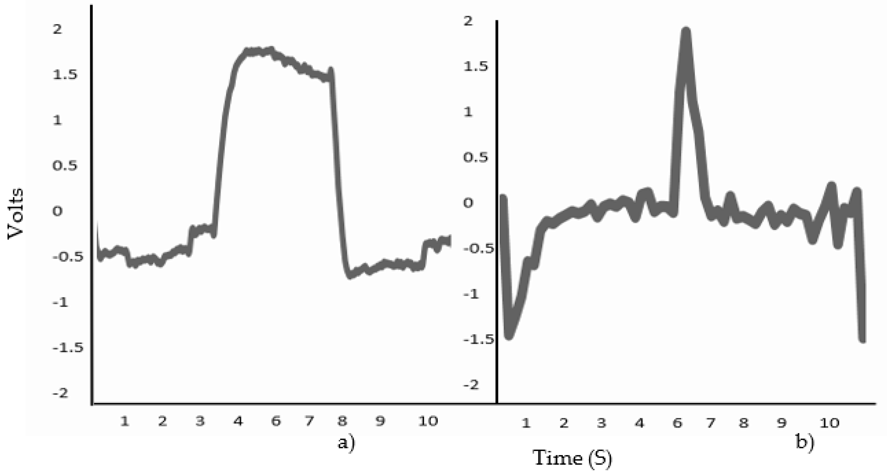Sensors | Free Full-Text | EOG Signal Classification with Wavelet and Supervised Learning ...
