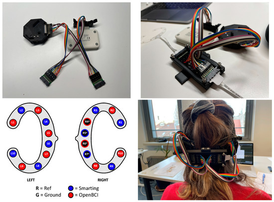 A Systematic Comparison of High-End and Low-Cost EEG Amplifiers for ...