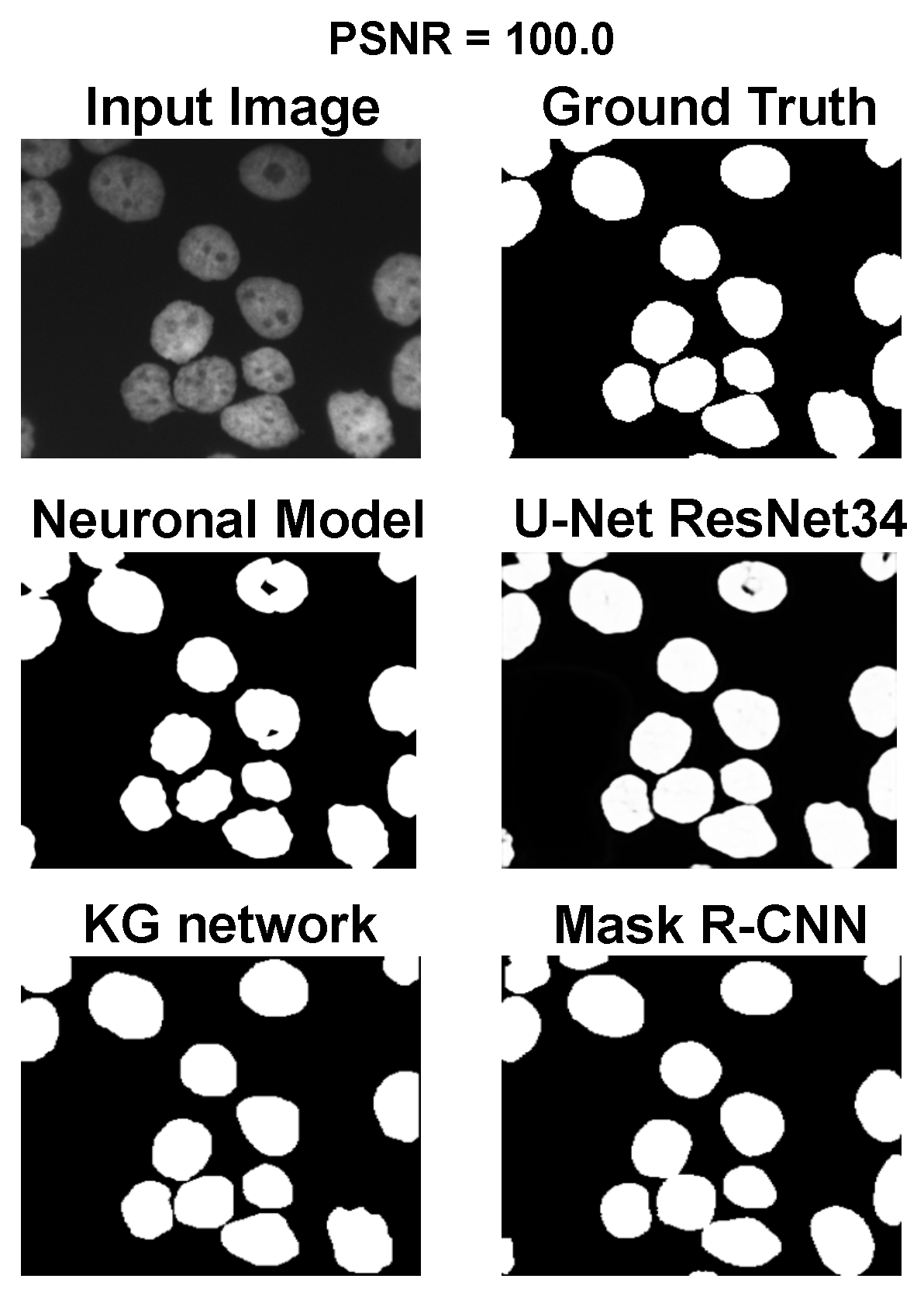NeuronAlg: An Innovative Neuronal Computational Model for ...