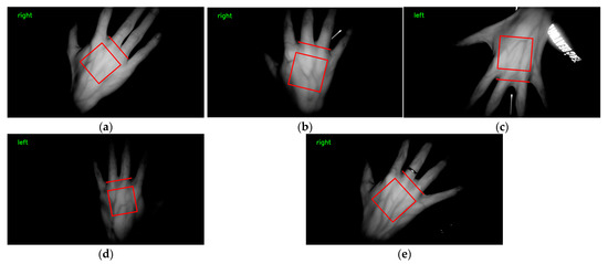Sensors | Free Full-Text | Fast and Accurate ROI Extraction for Non ...