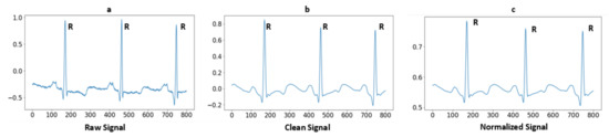 Hybrid Deep Learning and Discrete Wavelet Transform-Based ECG Biometric ...