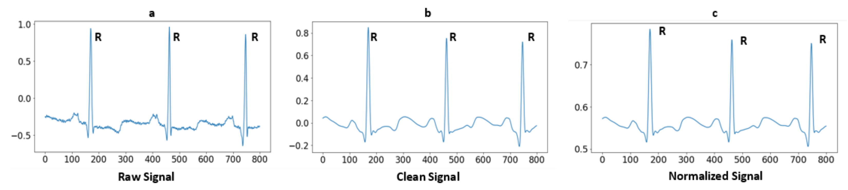 Sensors | Free Full-Text | Hybrid Deep Learning and Discrete Wavelet ...