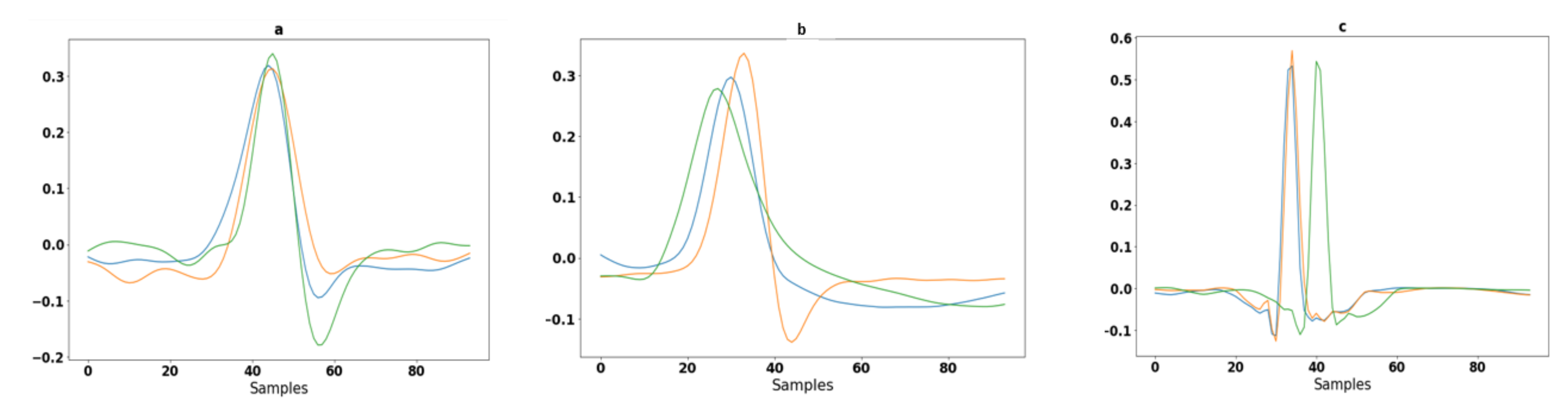 Sensors | Free Full-Text | Hybrid Deep Learning and Discrete Wavelet ...