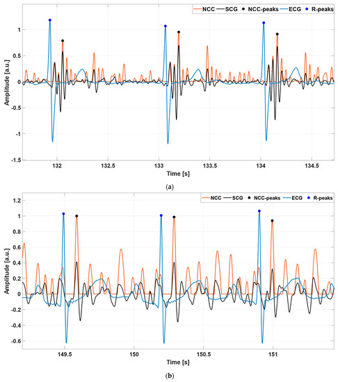 ECG-Free Heartbeat Detection in Seismocardiography Signals via Template ...
