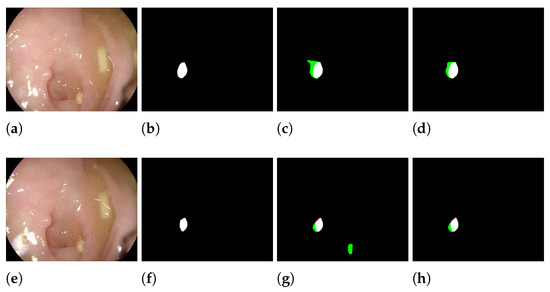 Ensembles of Convolutional Neural Networks and Transformers for Polyp Segmentation