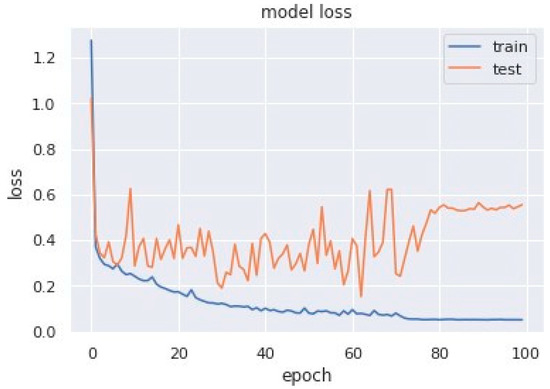 Efficient Deep Learning Based Hybrid Model to Detect Obstructive Sleep Apnea