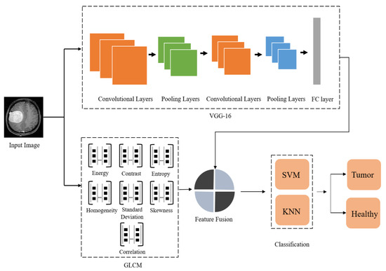 A Novel Approach for Brain Tumor Classification Using an Ensemble of ...