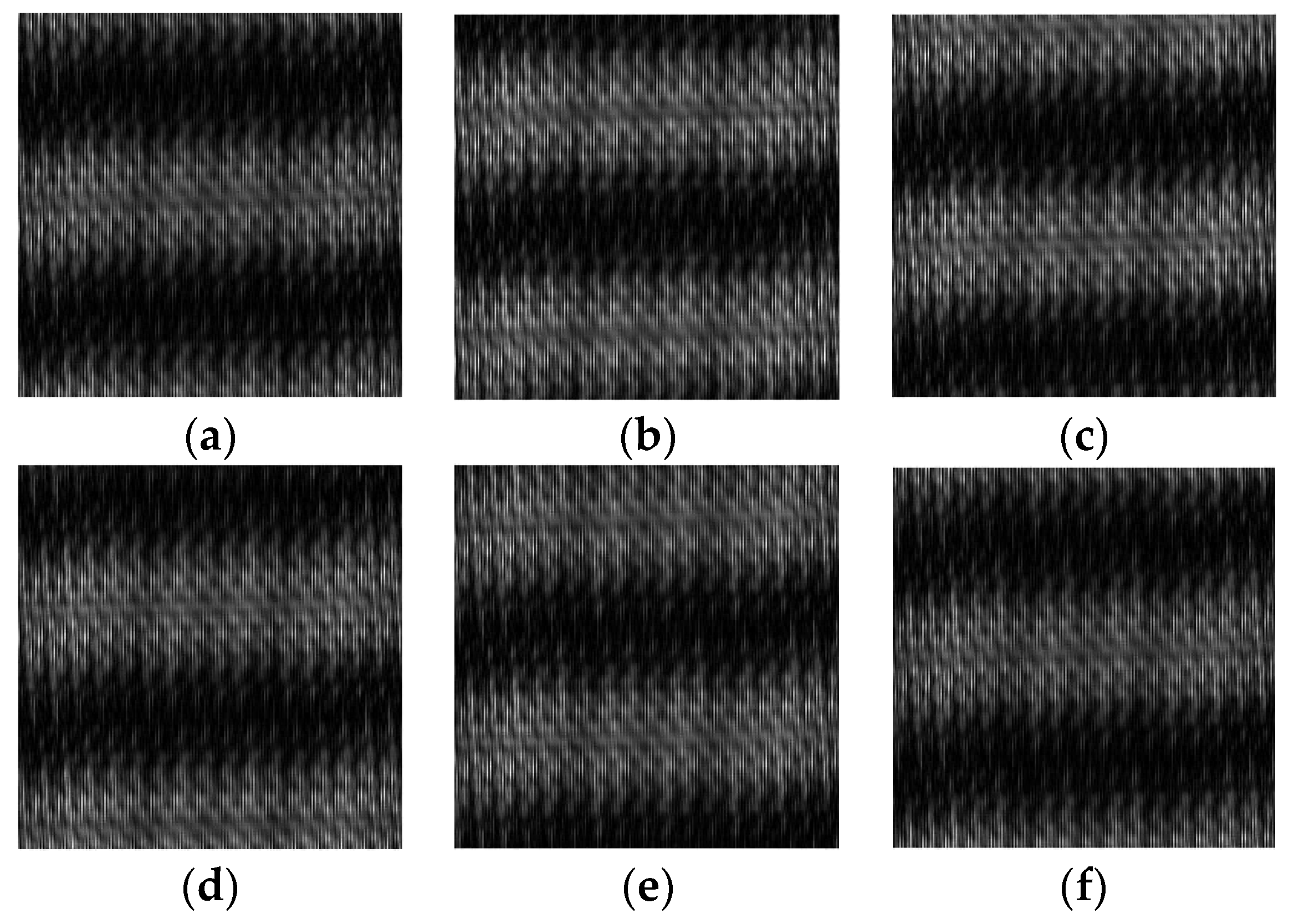 New-Type Shearing Interference Detection System Based on Double-Grating Structure for ...