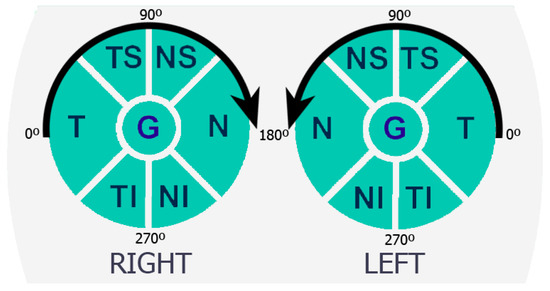 Analysis of the Asymmetry between Both Eyes in Early Diagnosis of ...
