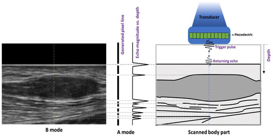 Skeletal Muscle Assessment Using Quantitative Ultrasound: A Narrative ...