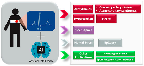 Electrocardiogram Monitoring Wearable Devices and Artificial ...