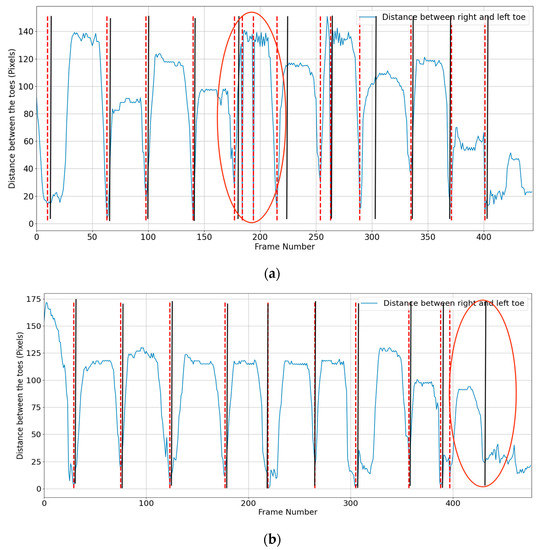 Automated Implementation of the Edinburgh Visual Gait Score (EVGS ...