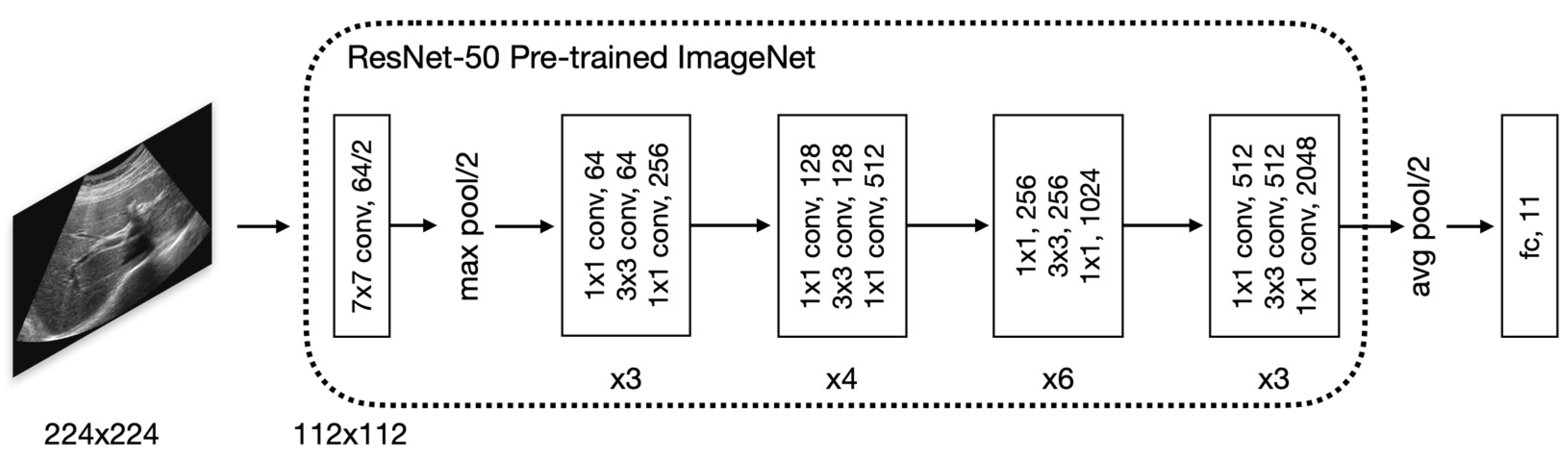 Real-Time Deep Recognition of Standardized Liver Ultrasound Scan Locations