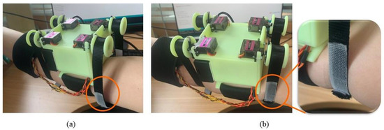 Design and Psychophysical Evaluation of a Novel Wearable Upper-Arm ...