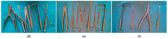 Surgical Instrument Detection Algorithm Based on Improved YOLOv7x