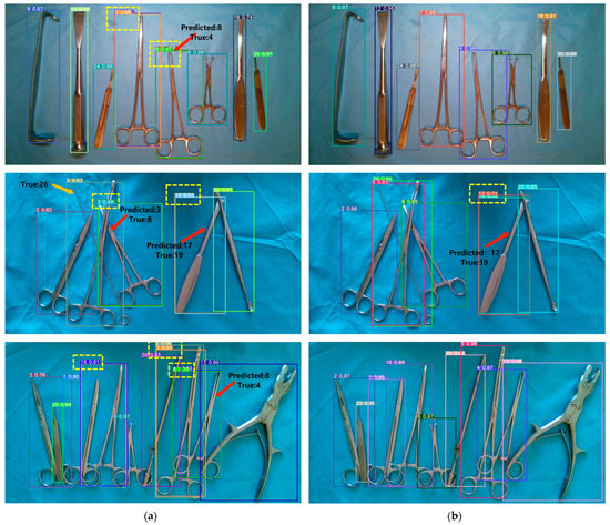 Surgical Instrument Detection Algorithm Based on Improved YOLOv7x