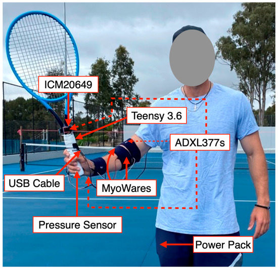 Comparison of Grip Strength, Forearm Muscle Activity, and Shock ...