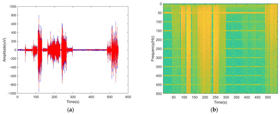 Sensors Free Full Text Reducing Power Line Interference From Semg Signals Based On