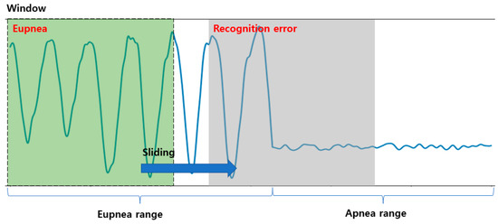 Detection of Multiple Respiration Patterns Based on 1D SNN from ...
