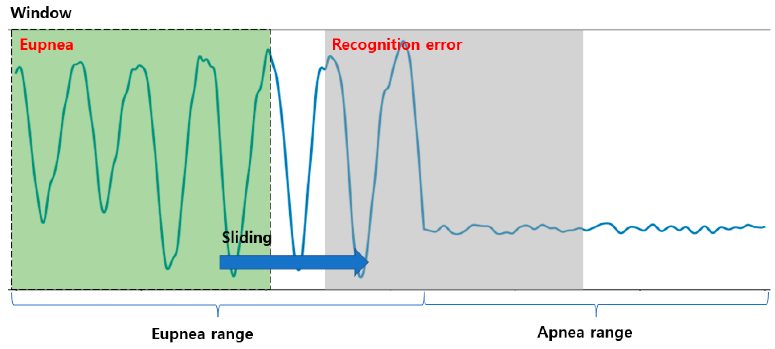 Detection of Multiple Respiration Patterns Based on 1D SNN from ...