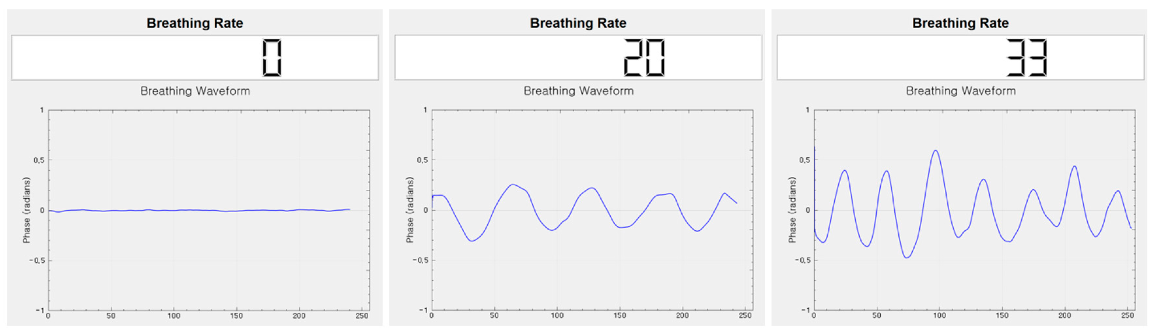 Detection of Multiple Respiration Patterns Based on 1D SNN from Continuous Human Breathing ...