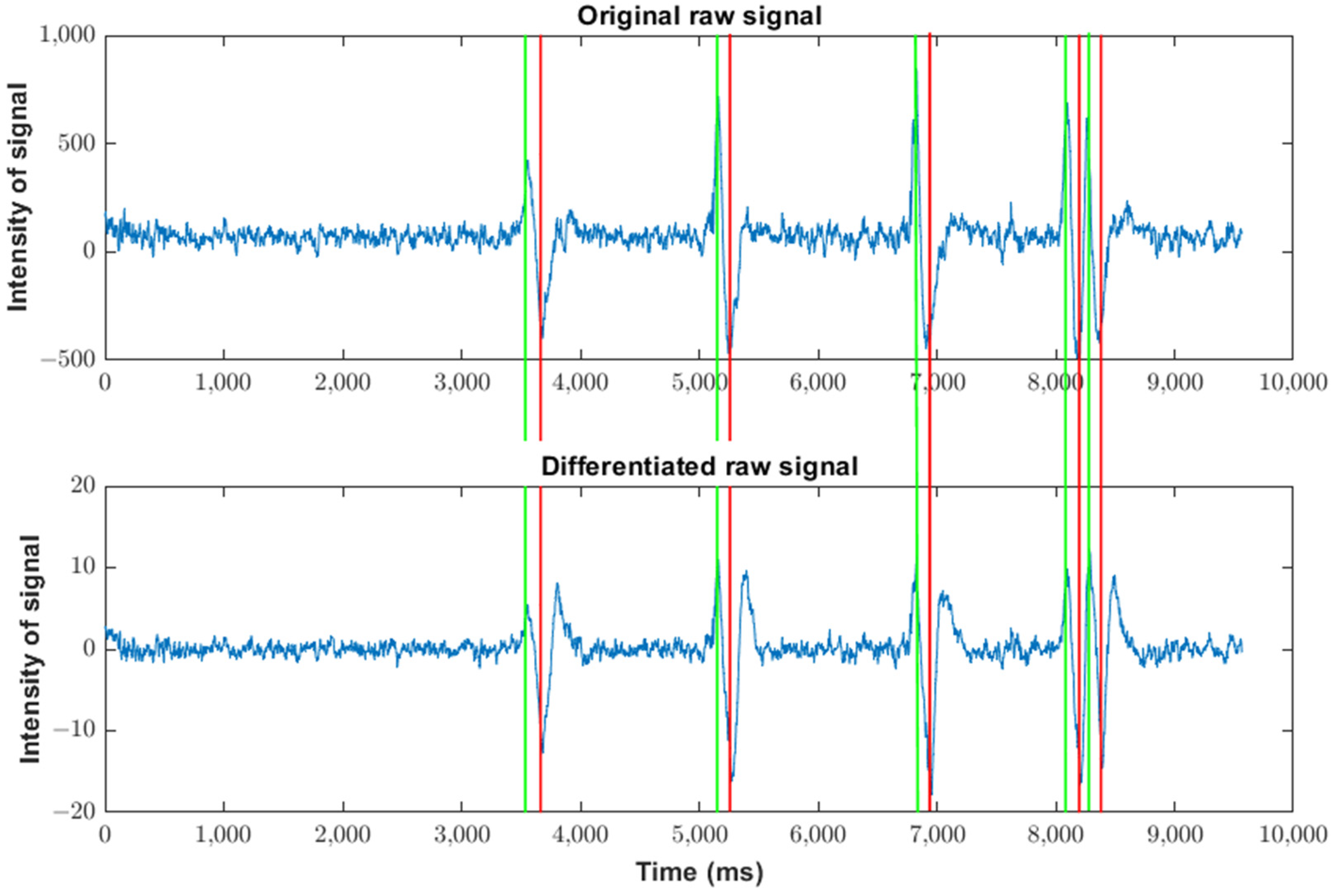 A Hardware-Based Configurable Algorithm for Eye Blink Signal Detection Using a Single-Channel ...