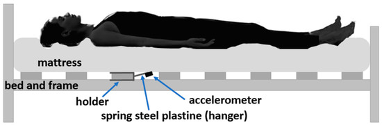 Monitoring of Cardiorespiratory Parameters during Sleep Using a Special Holder for the ...