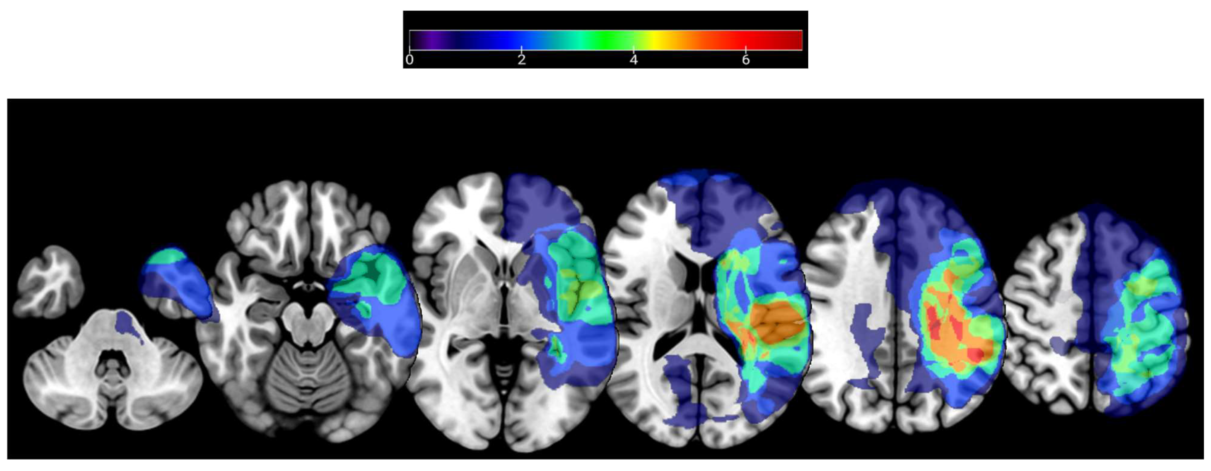 Associating Functional Neural Connectivity and Specific Aspects of ...