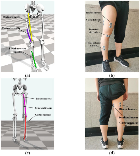 Prediction of Joint Angles Based on Human Lower Limb Surface Electromyography