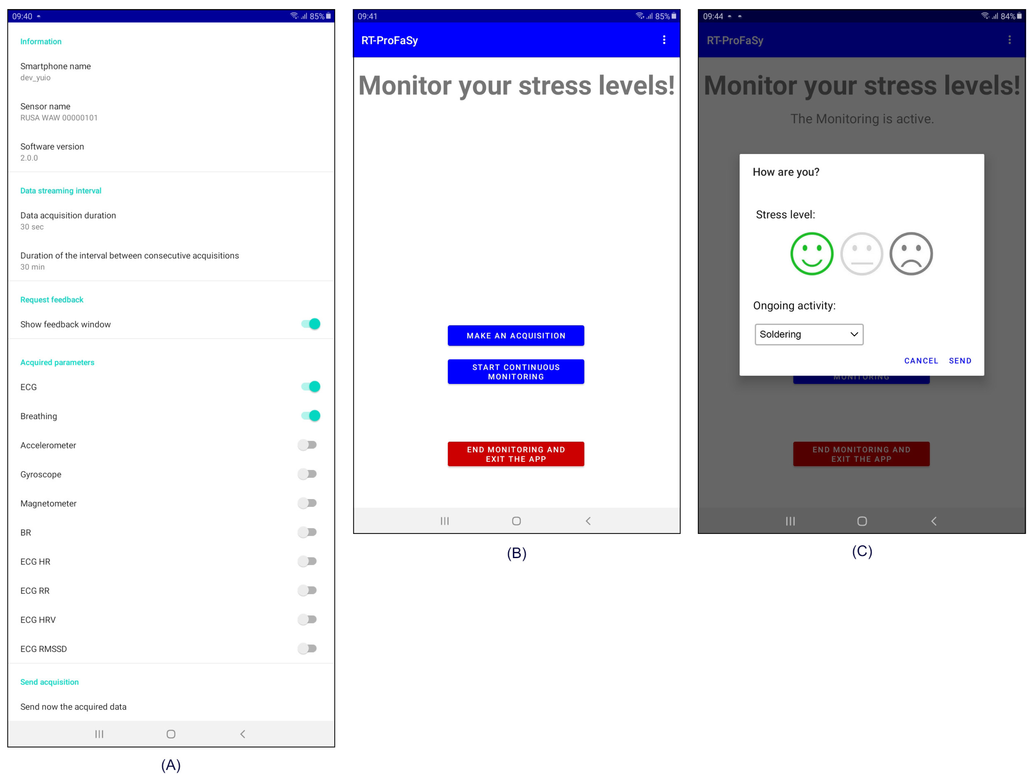 Sensors | Free Full-Text | ECG-Based Stress Detection and Productivity ...
