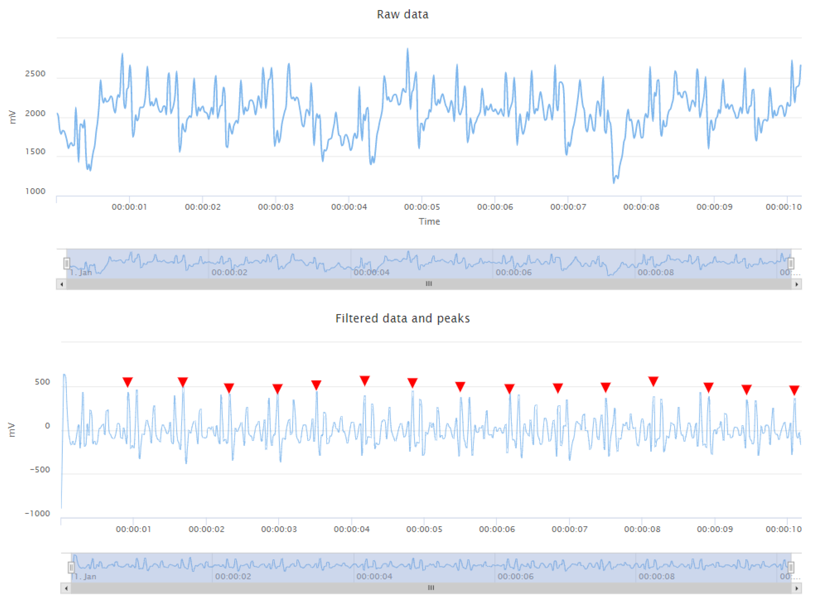 Sensors | Free Full-Text | ECG-Based Stress Detection and Productivity ...