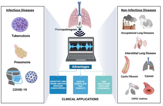 Digital Pulmonology Practice with Phonopulmography Leveraging ...