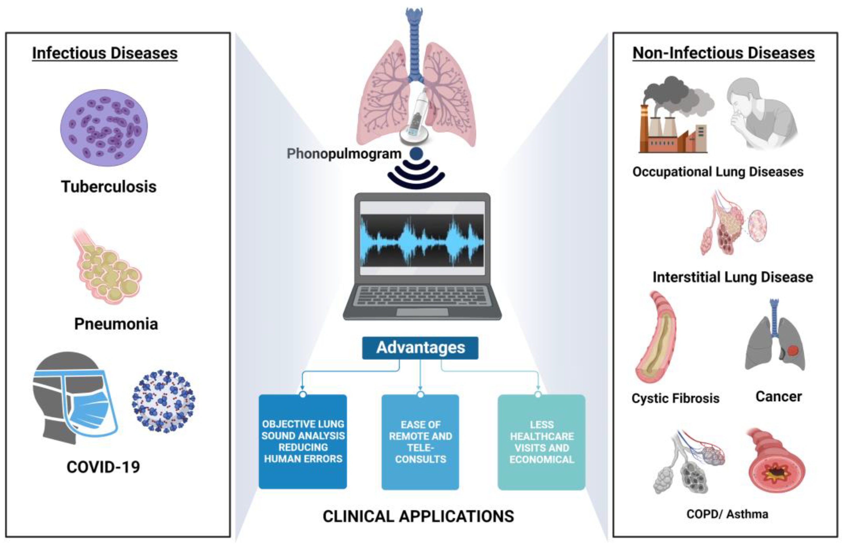 Digital Pulmonology Practice with Phonopulmography Leveraging Artificial Intelligence: Future ...