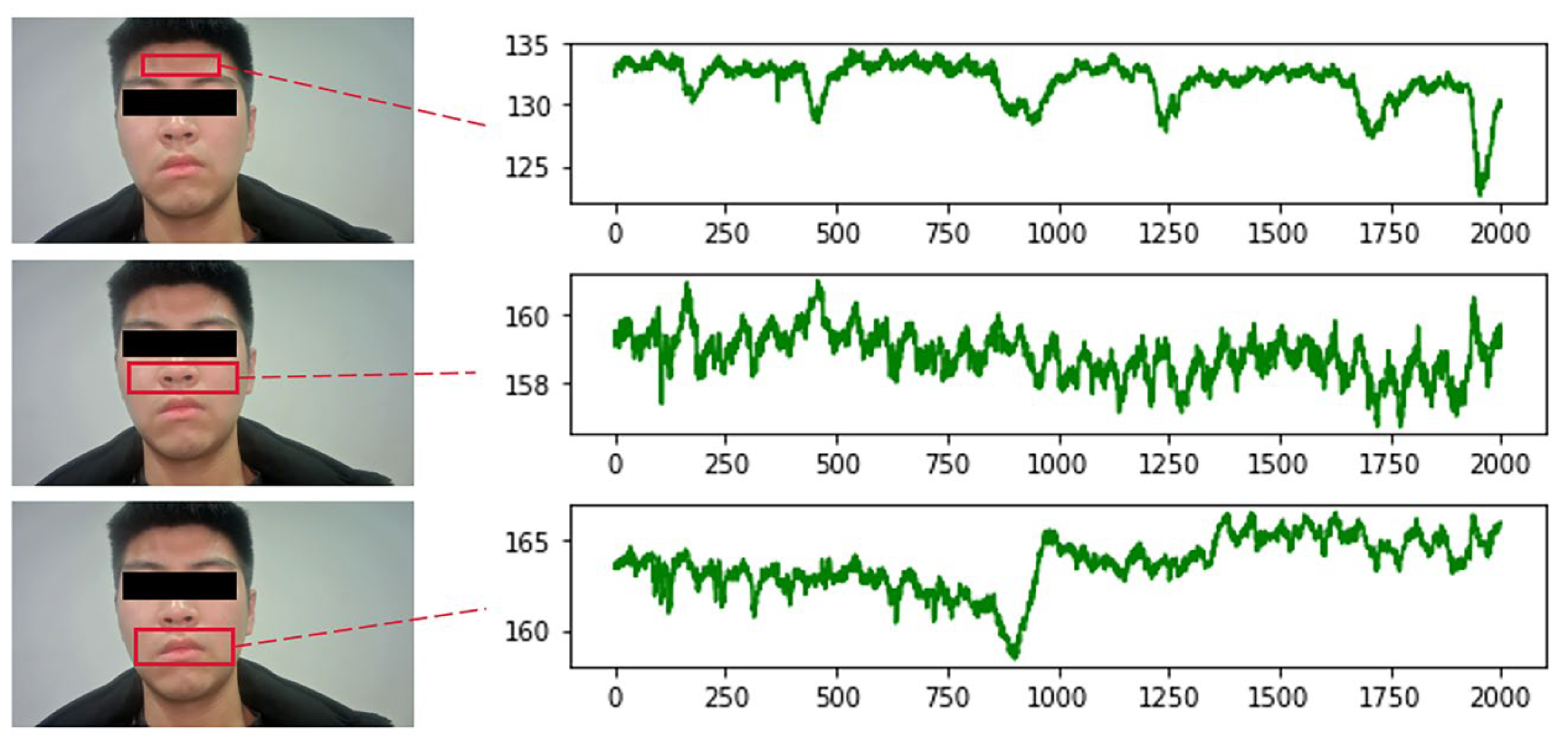 Deep Learning-Based Non-Contact IPPG Signal Blood Pressure Measurement ...
