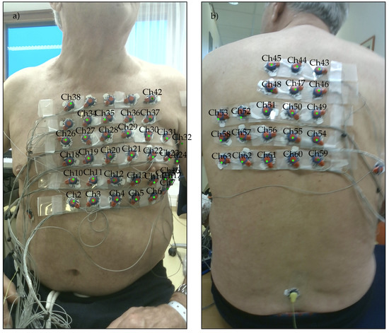 ECG Electrode Localization: 3D DS Camera System for Use in Diverse ...